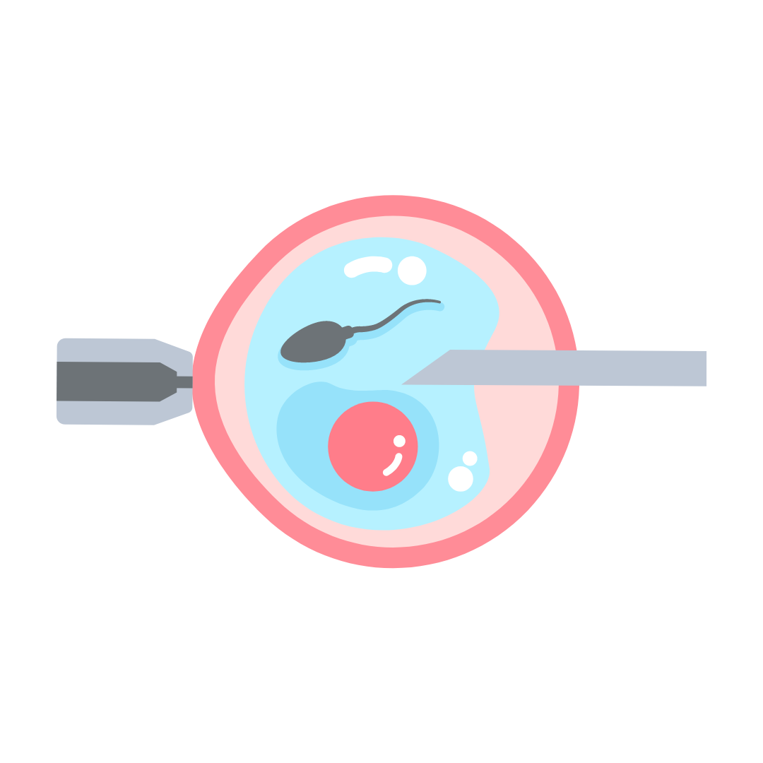 ICSI: Qué es y por qué tiene mejores tasas de éxito | IVFforYOU